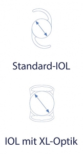 IOL-Katarakt-cataract-Standard-XL-Optik | HumanOptics