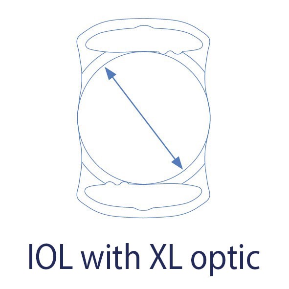 humanoptics-iol-xl-optic-aspira-axa-diameter-cataract | HumanOptics