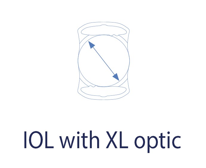 humanoptics-iol-xl-optic-aspira-axa-diameter-cataract | HumanOptics