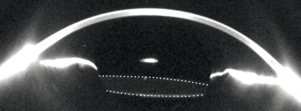 HO_Scheimpflug_Aufnahme | HumanOptics