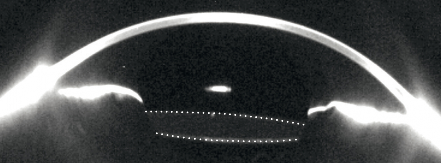 HO_Scheimpflug_Aufnahme | HumanOptics