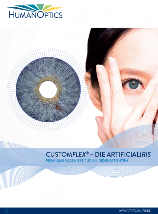 customflex-artificialiris-produktbroschüre | HumanOptics