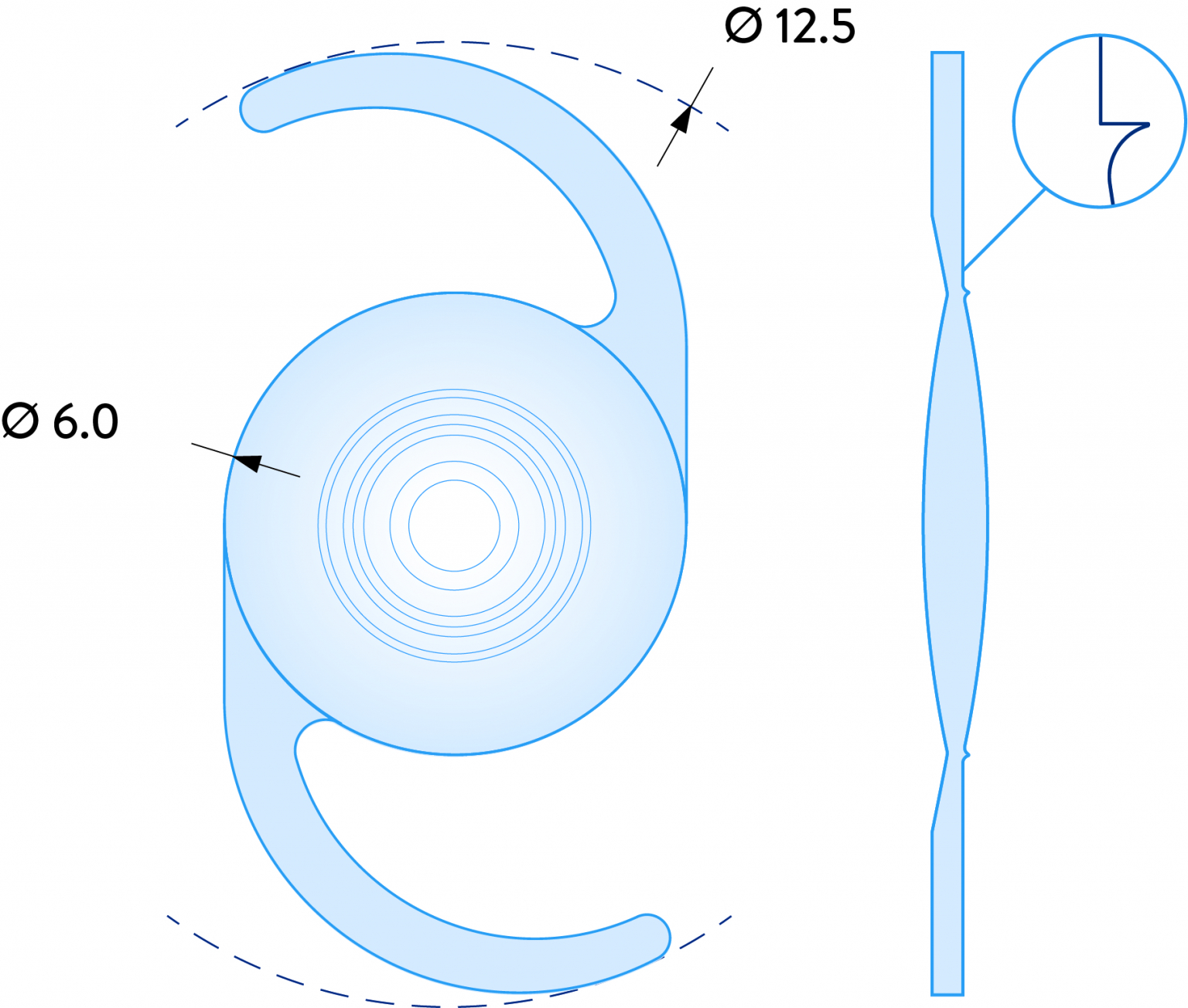 RZ_Triva_aA_mass_en | HumanOptics